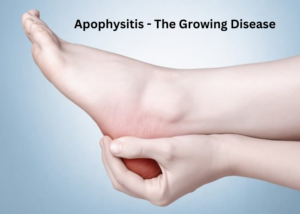 Apophysitis: Understanding and Managing the Growing Disease